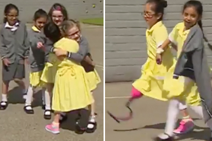 Girl with new prosthetic leg--Aleteia