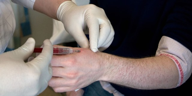 Chip implants are here, there, and everywhere