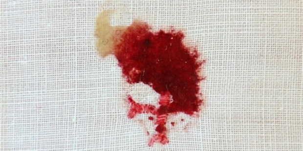 The stunning Eucharistic miracle of Sokolka