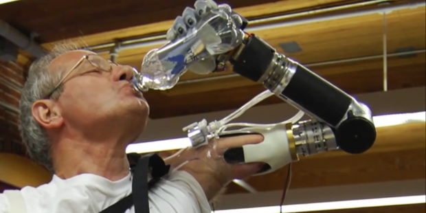 The Amazing Luke, Prosthetic Arm--Aleteia