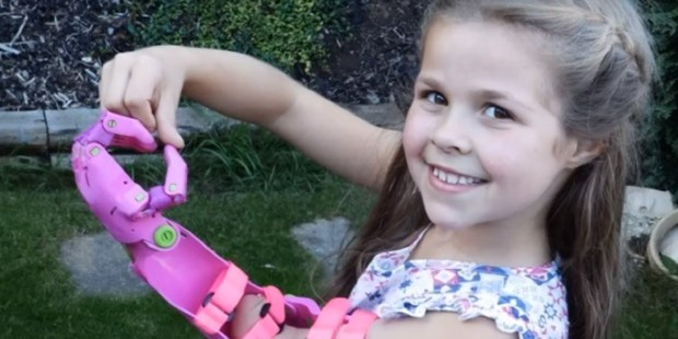 Watch this little girl’s joy at receiving a prosthetic arm for the ...