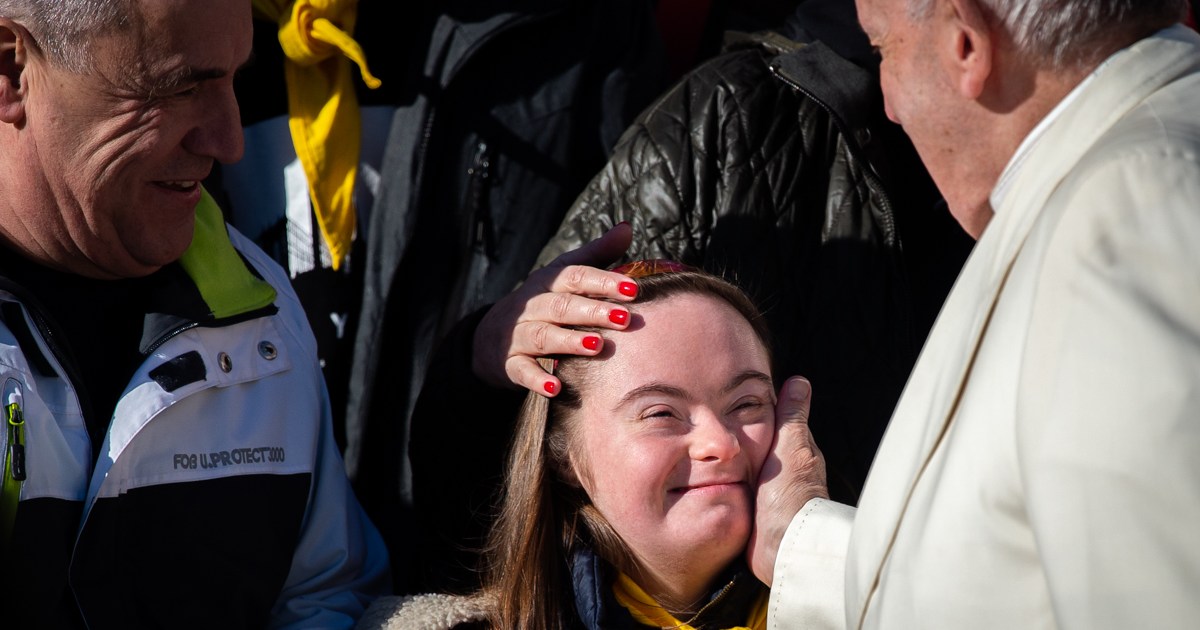Pope Francis says disabled persons contribute to common good--Aleteia